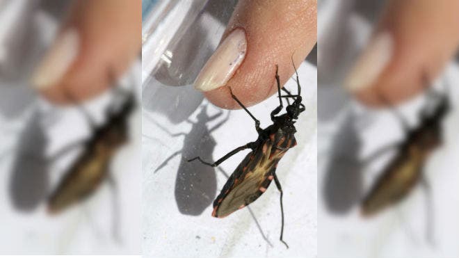 Chagas disease: What to know about ‘kissing bugs’ | Fox News
