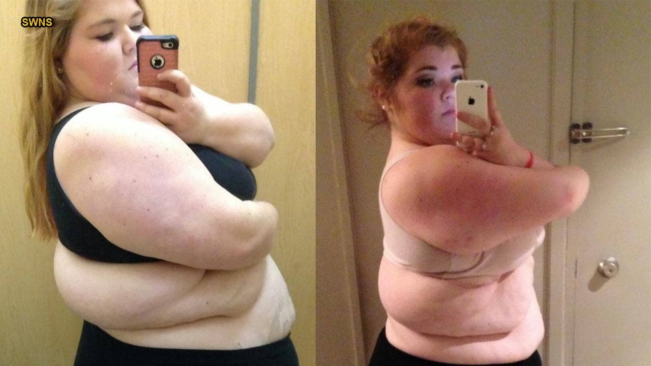 Obese high school student who attempted suicide drops 157 pounds | Fox News Obese high school student who attempted suicide drops 157 pounds | Fox News