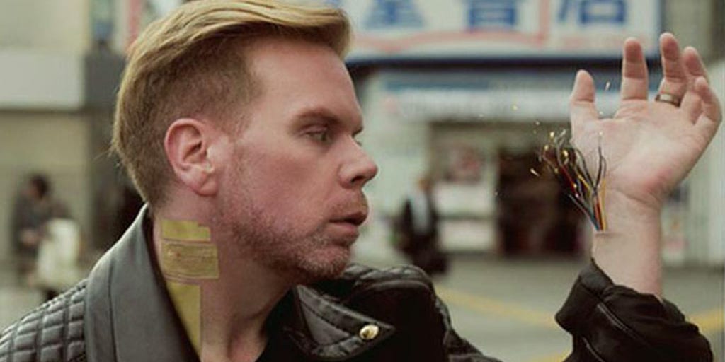 A real–life cyborg? Here is the world’s most connected man | Fox ...