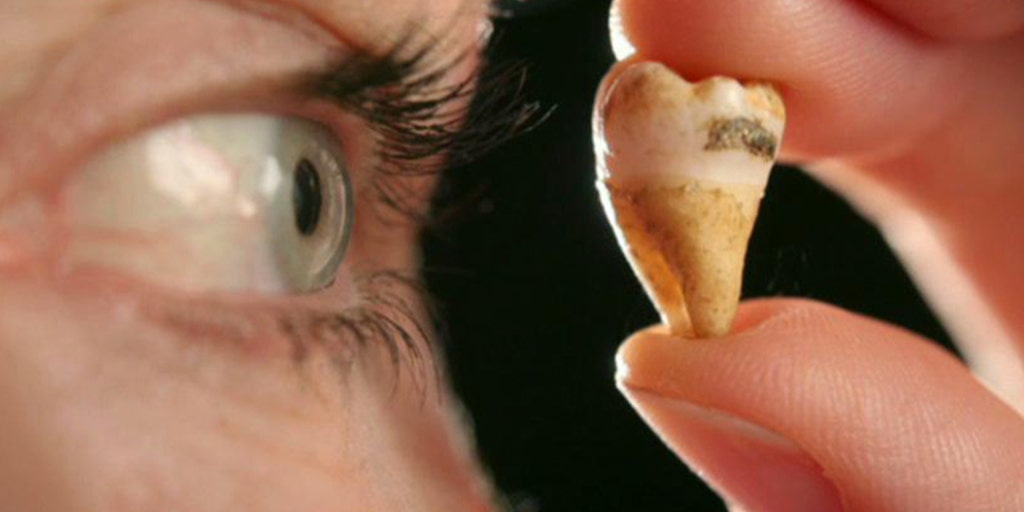 Dentist wants to clone John Lennon using DNA from tooth | Fox News Video