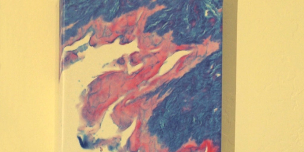 Umbilical cord photographs: art or eww? | Fox News Video