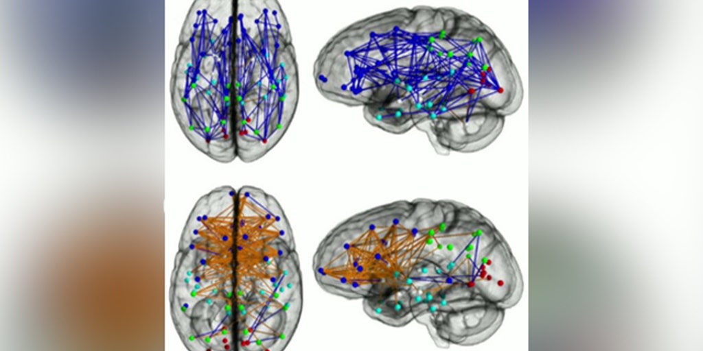 Study reveals male, female brains wired differently | Fox News Video