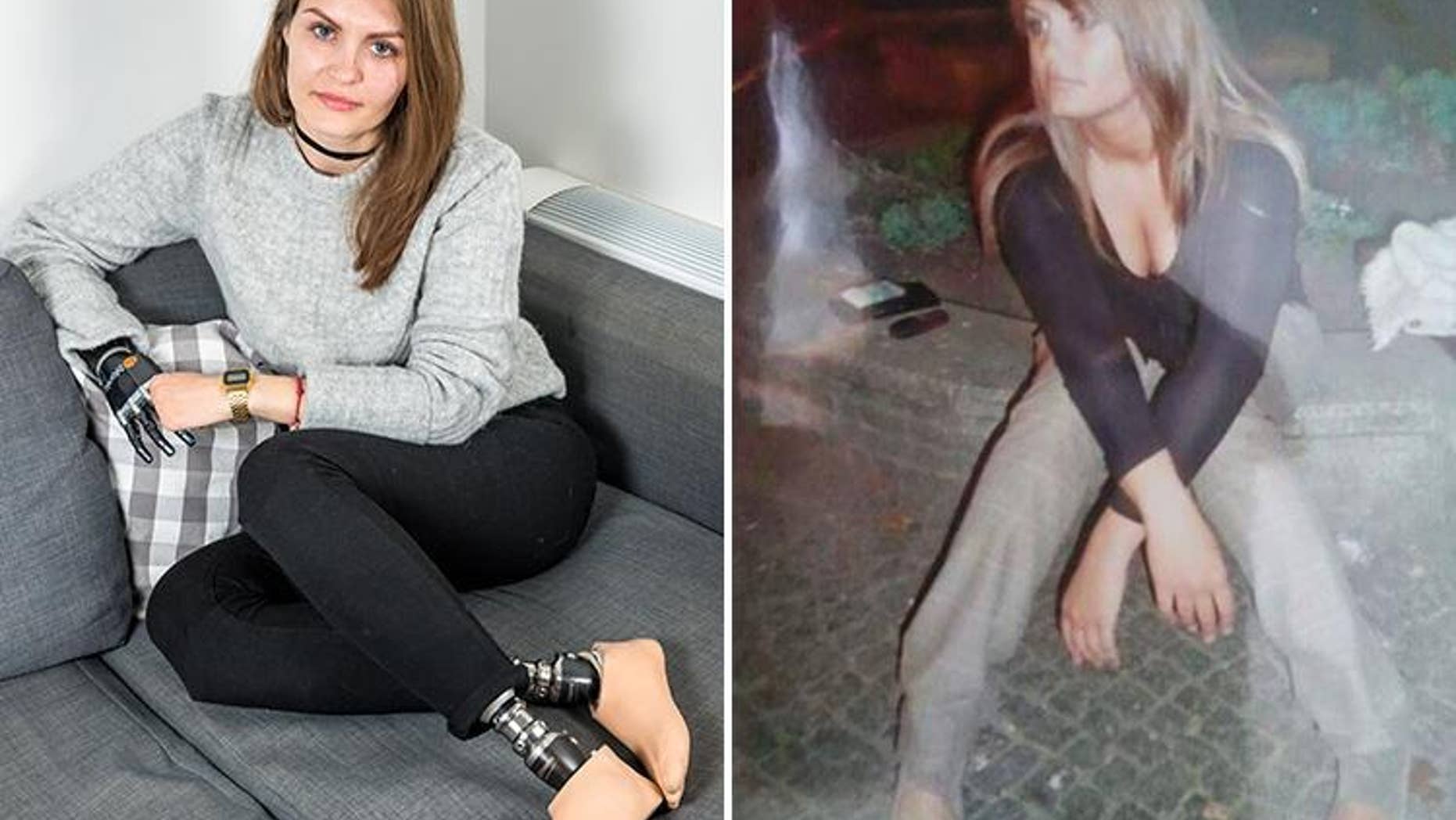 Mom has arm, fingers, both legs cut off after doctors failed to spot ... Mom has arm, fingers, both legs cut off after doctors failed to spot ...