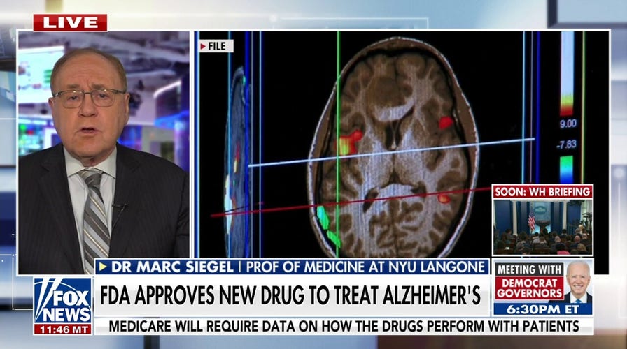 High blood pressure could increase odds for Alzheimer’s disease: study ... High blood pressure could increase odds for Alzheimer’s disease: study ...