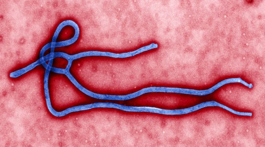 CDC warns of Marburg virus after deadly Africa outbreak | Fox News CDC warns of Marburg virus after deadly Africa outbreak | Fox News
