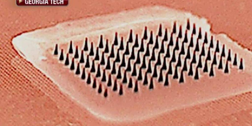 New flu patch a homerun so far: Dr. Marc Siegel | Fox Business Video