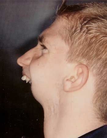 Jawless Boy Begins Long Road to Reconstruction | Fox News