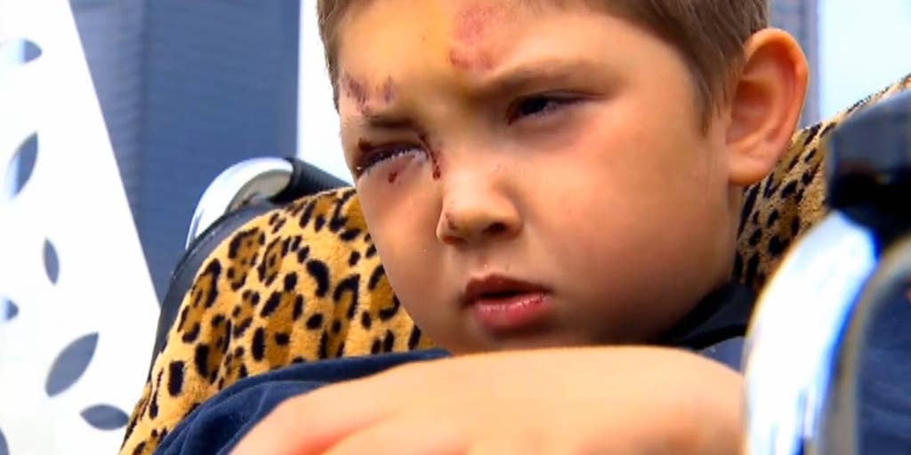 6 Year Old Beaten After Standing Up To Bullies Fox News Video