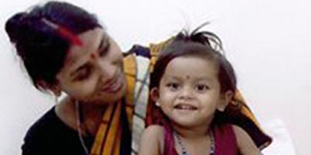 8 Limbed Girl Gets Surgery | Fox News Video