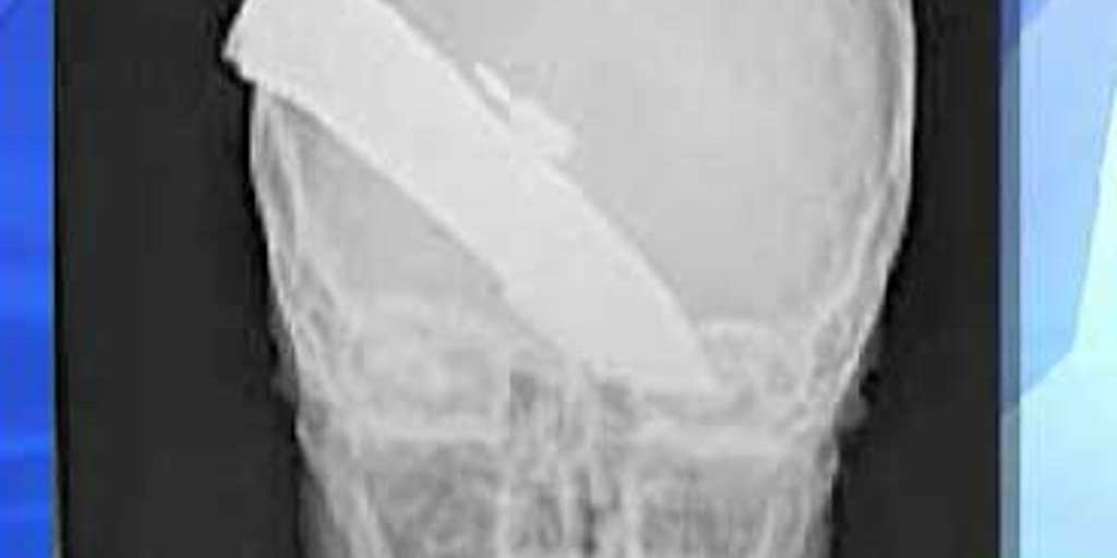 Blade Attack | Fox News Video