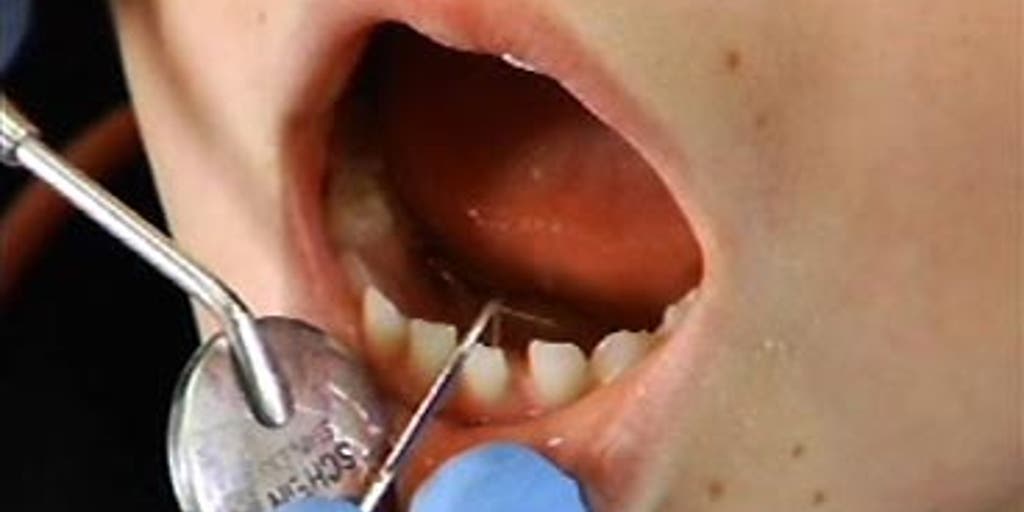 Disease-Fighting Teeth? | Fox News Video