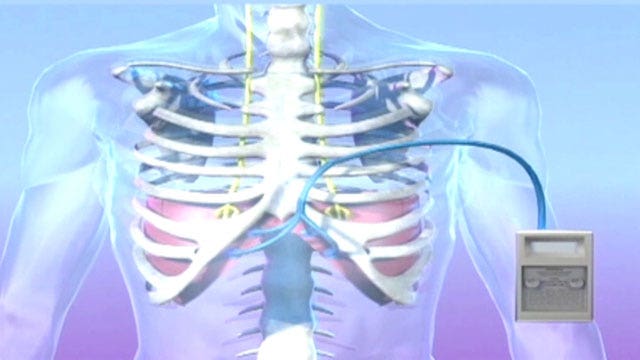 New device helps ALS patients breathe easier| Latest News Videos | Fox News