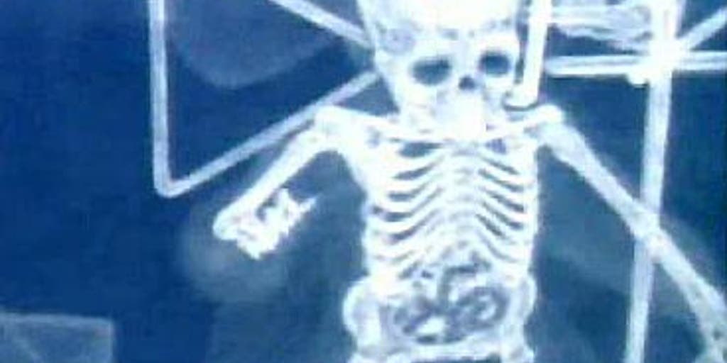 Radiation Danger? | Fox News Video