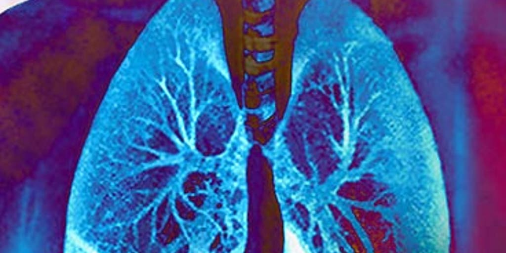 Breathing Easier | Fox News Video