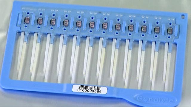 10-minute Ebola diagnostic test announced by startup company | Fox News ...
