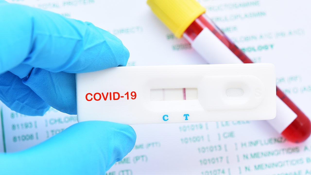 Where can you get a coronavirus test? | Fox Business