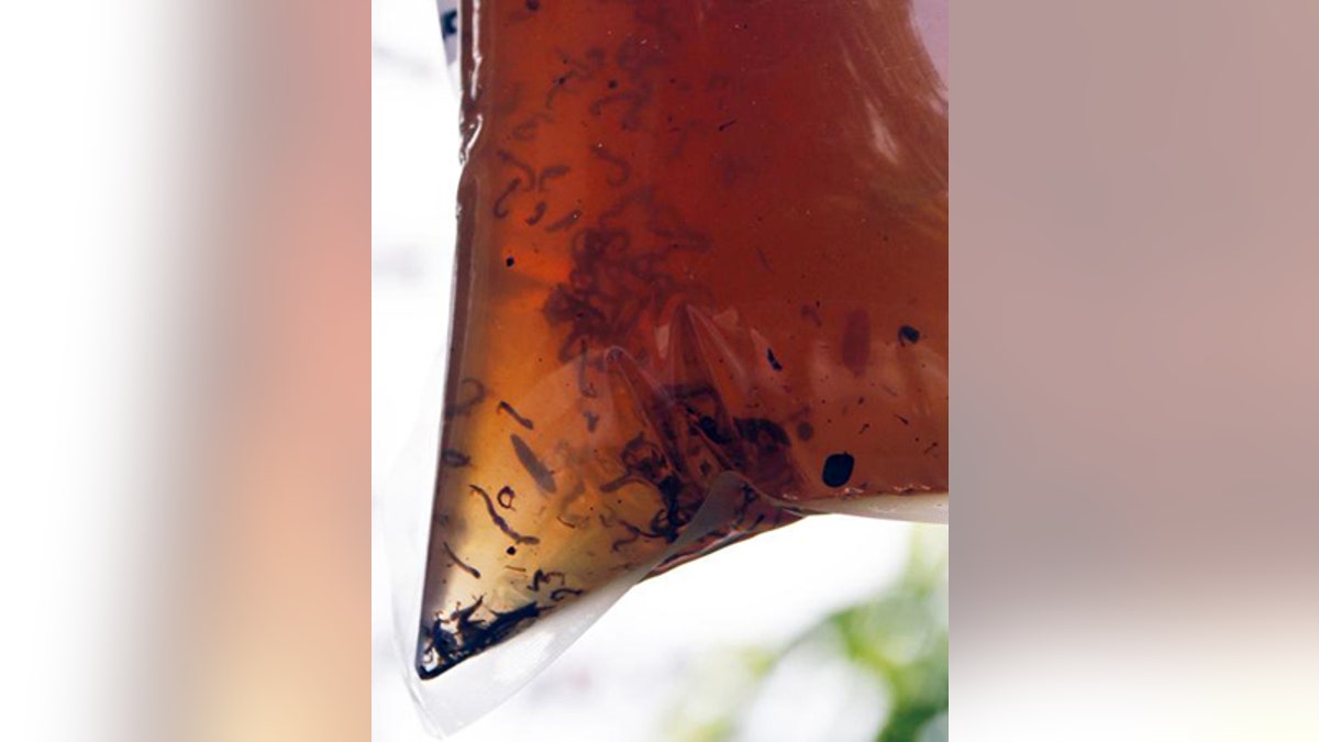 What Is Dengue Fever? | Fox News