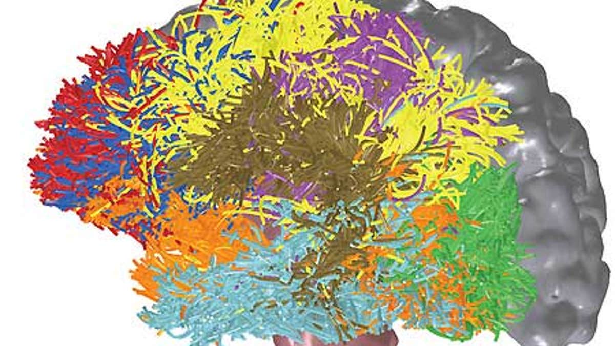 IBM Builds Biggest Cat Brain Ever | Fox News