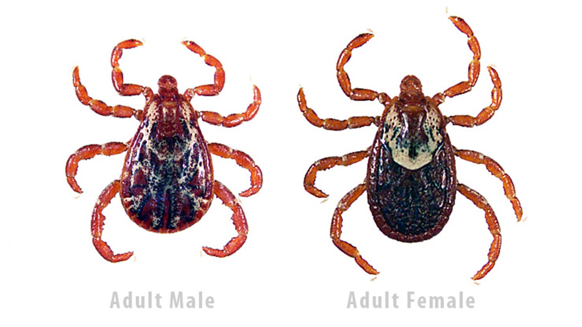 What is Rocky Mountain spotted fever? Signs, symptoms and treatment for ...