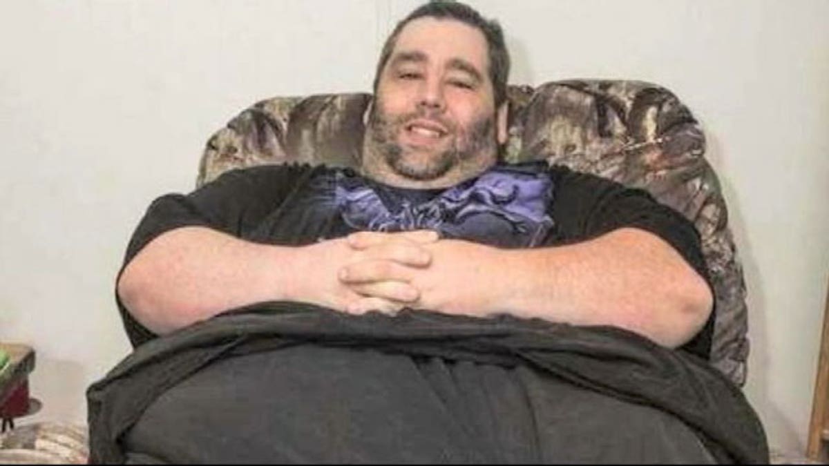Wesley Warren Scrotal Lymphedema
