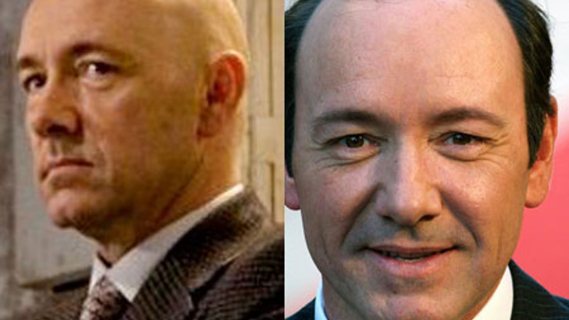 Better Bald or Bushy? | Fox News