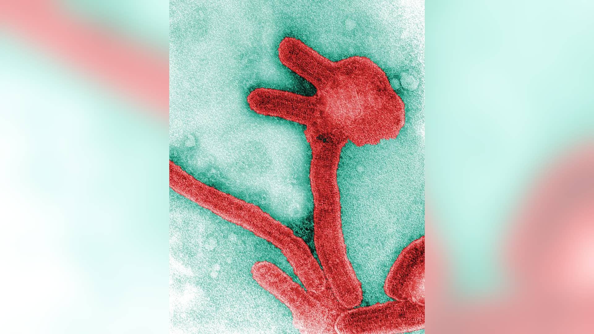 Dangerous Beauty: A Close Look at Deadly Diseases | Fox News