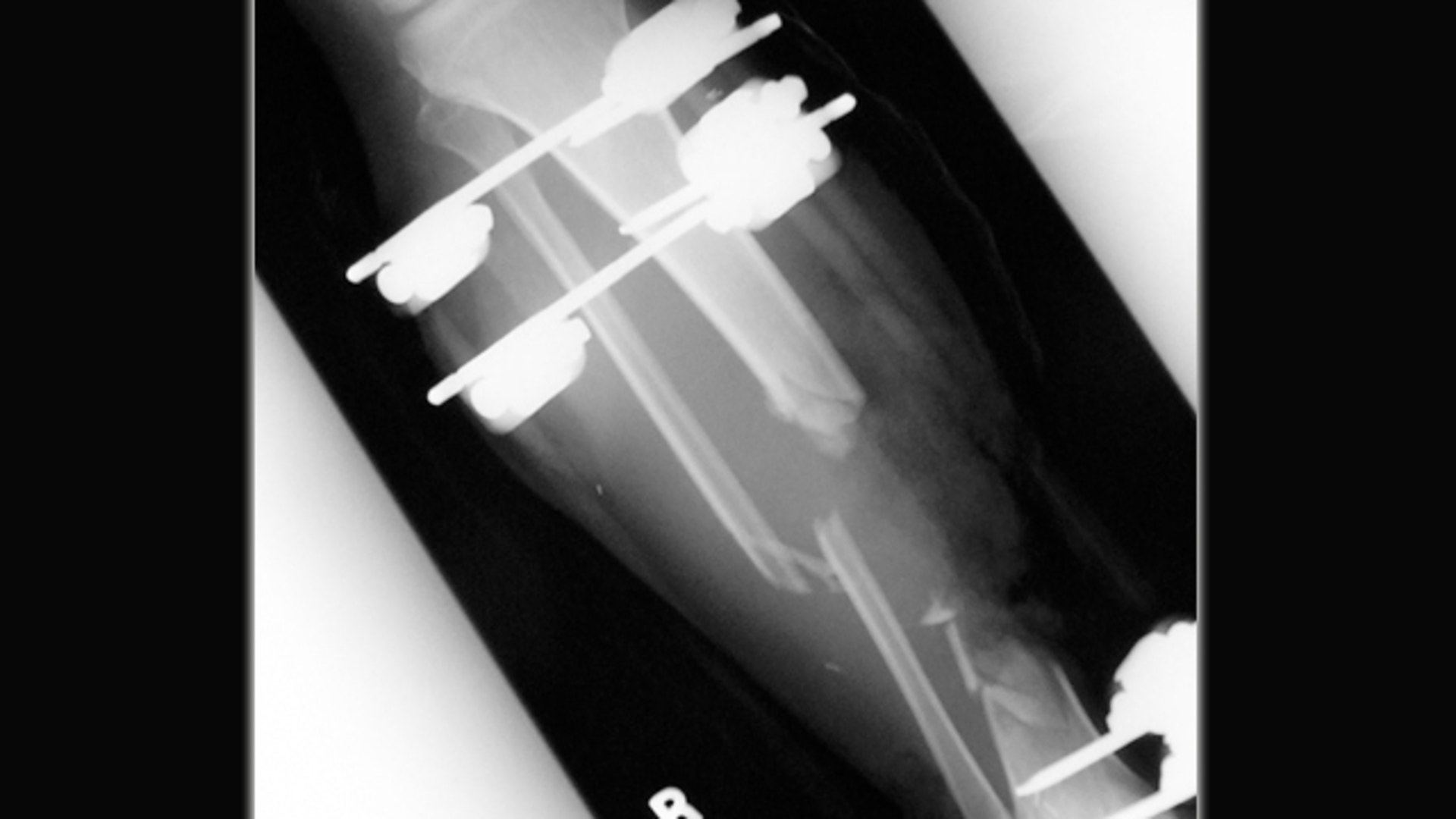 Outrageous injuries | Fox News