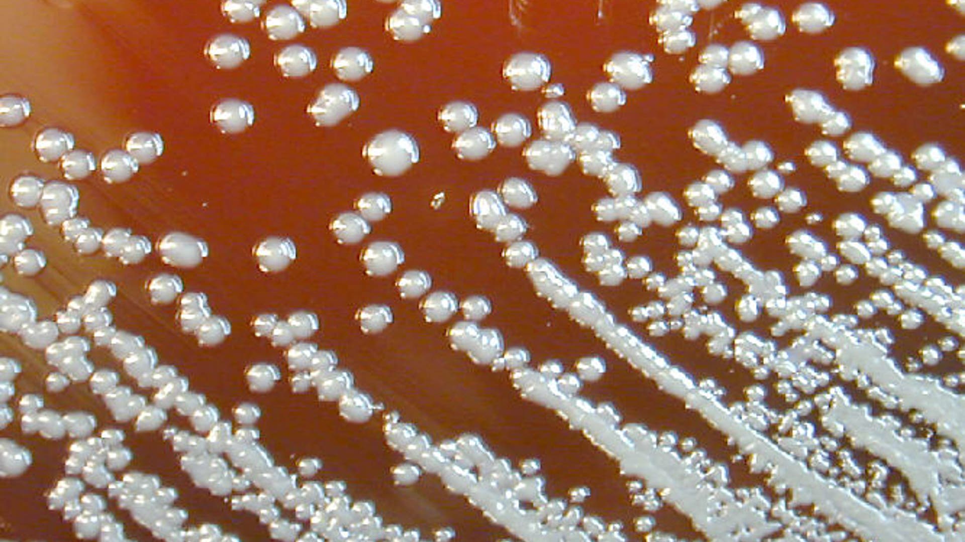 Dangerous Beauty: A Close Look at Deadly Diseases | Fox News