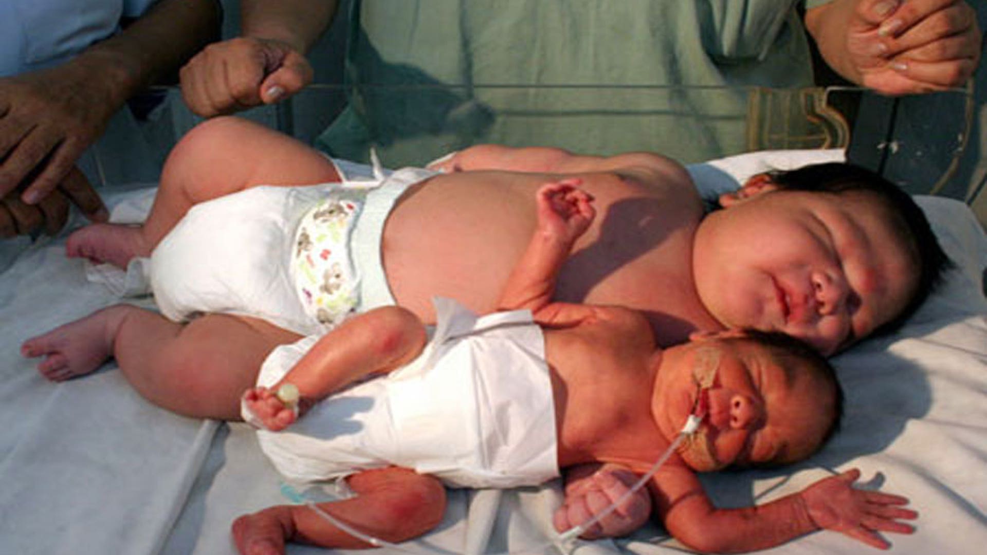 World's biggest babies | Fox News