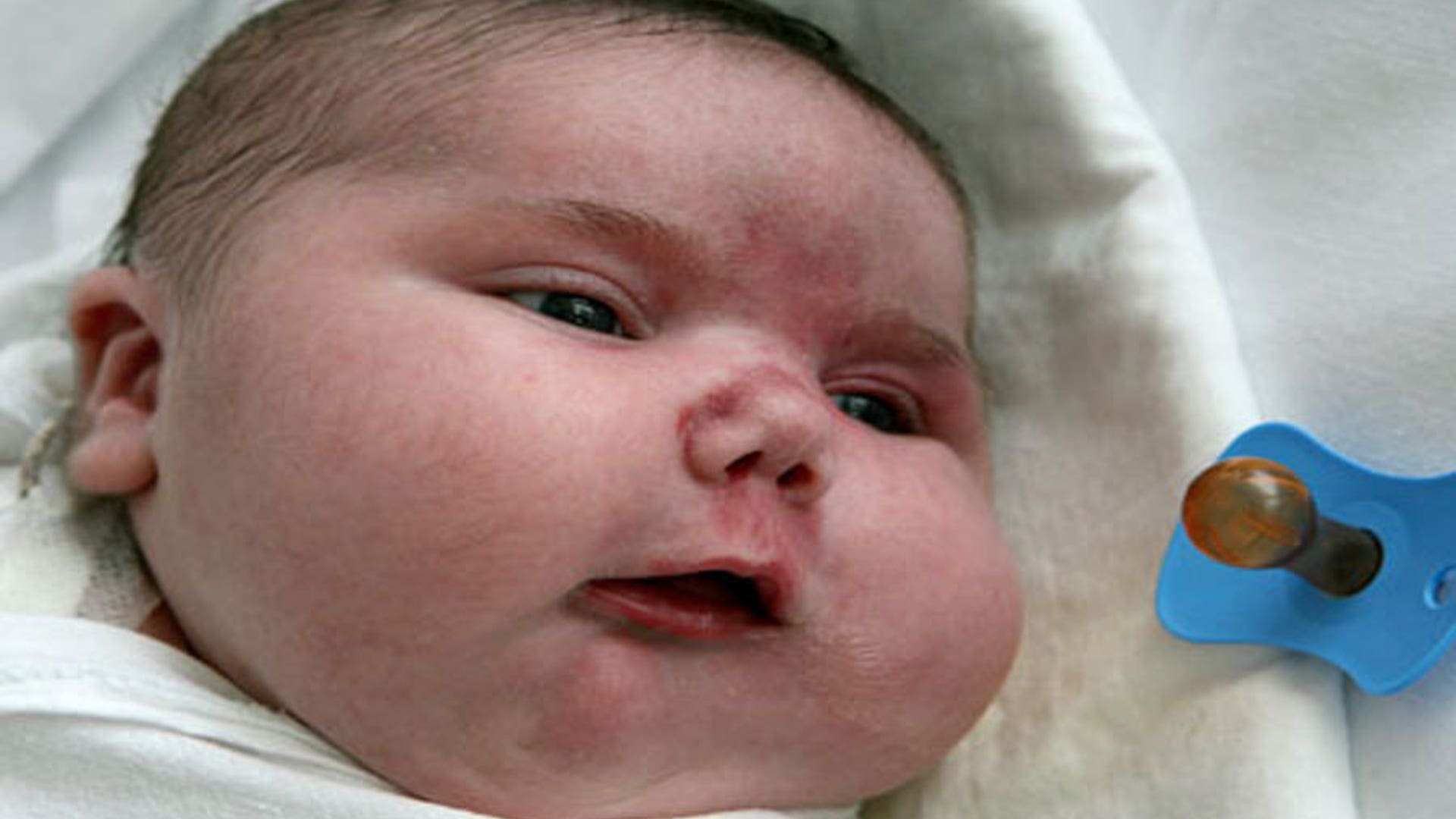 World's biggest babies | Fox News