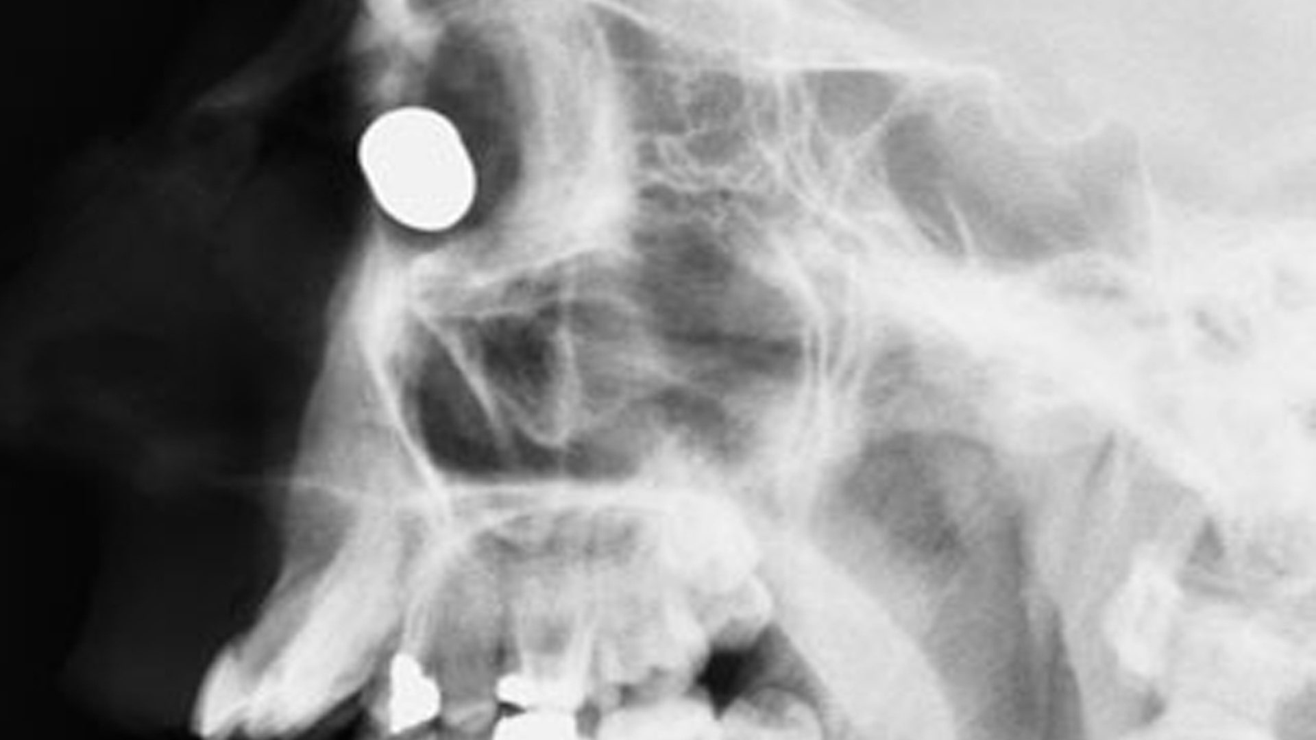 Outrageous injuries | Fox News