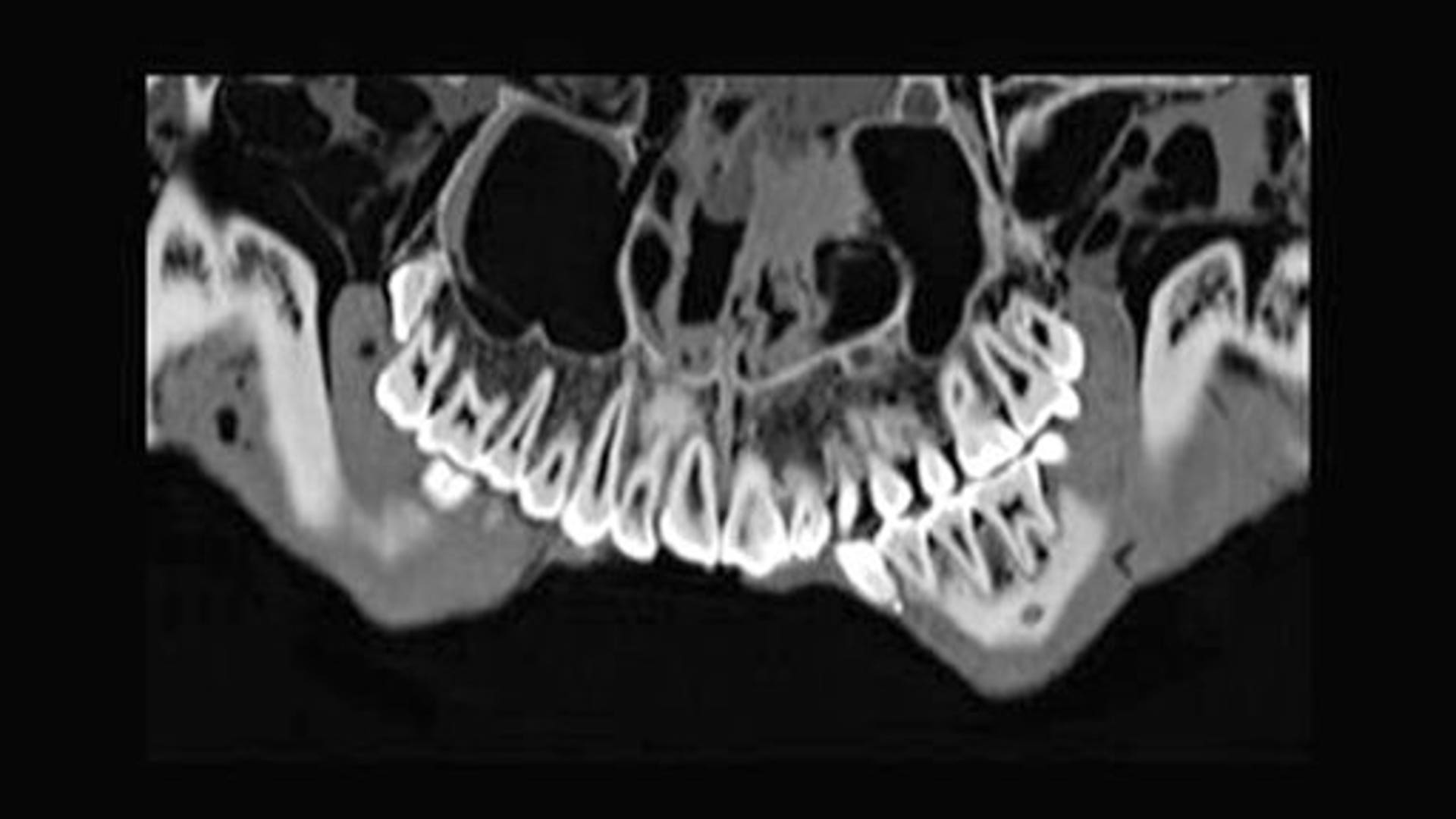 Unwrapping King Tut | Fox News