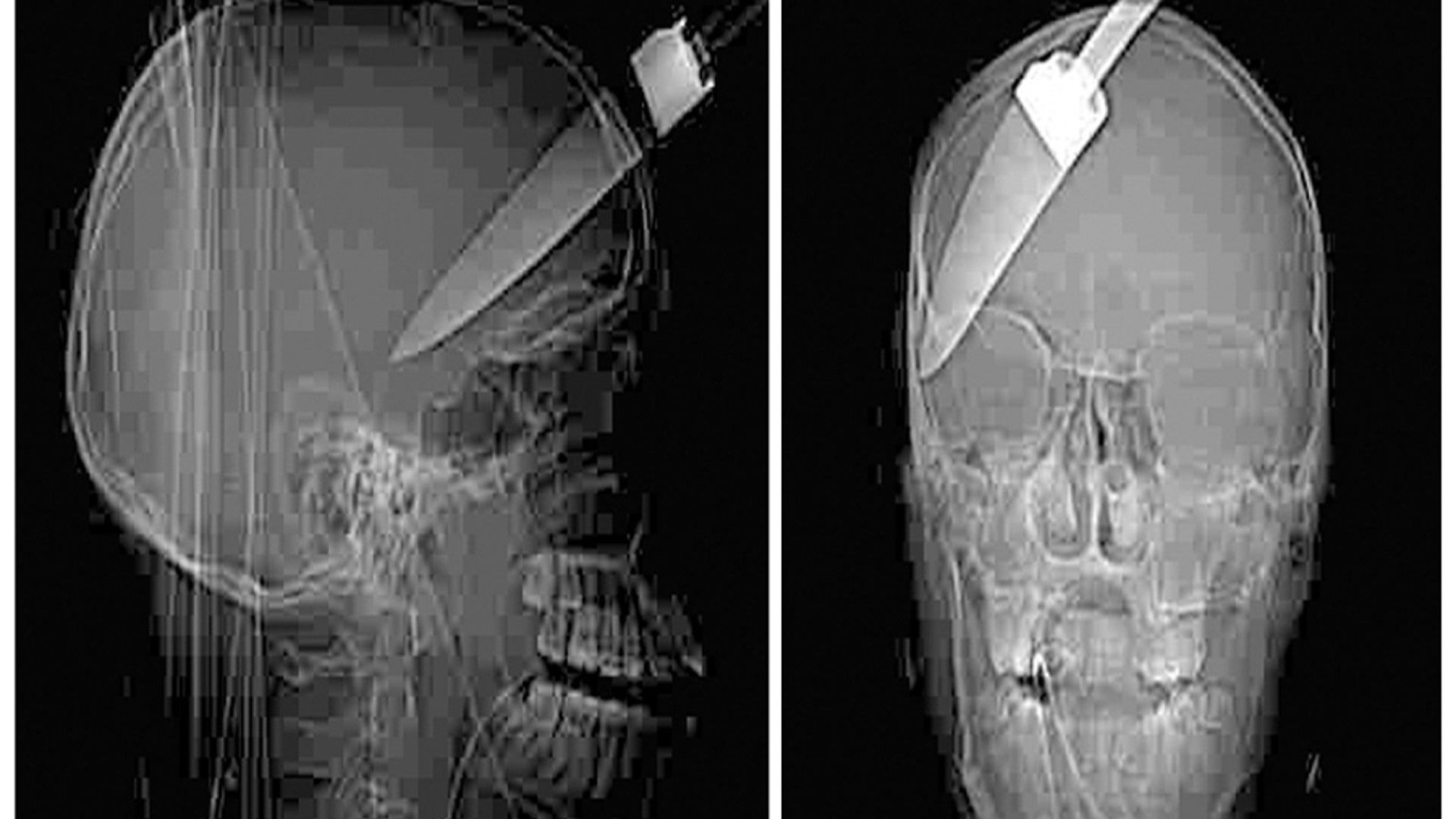 Outrageous injuries | Fox News