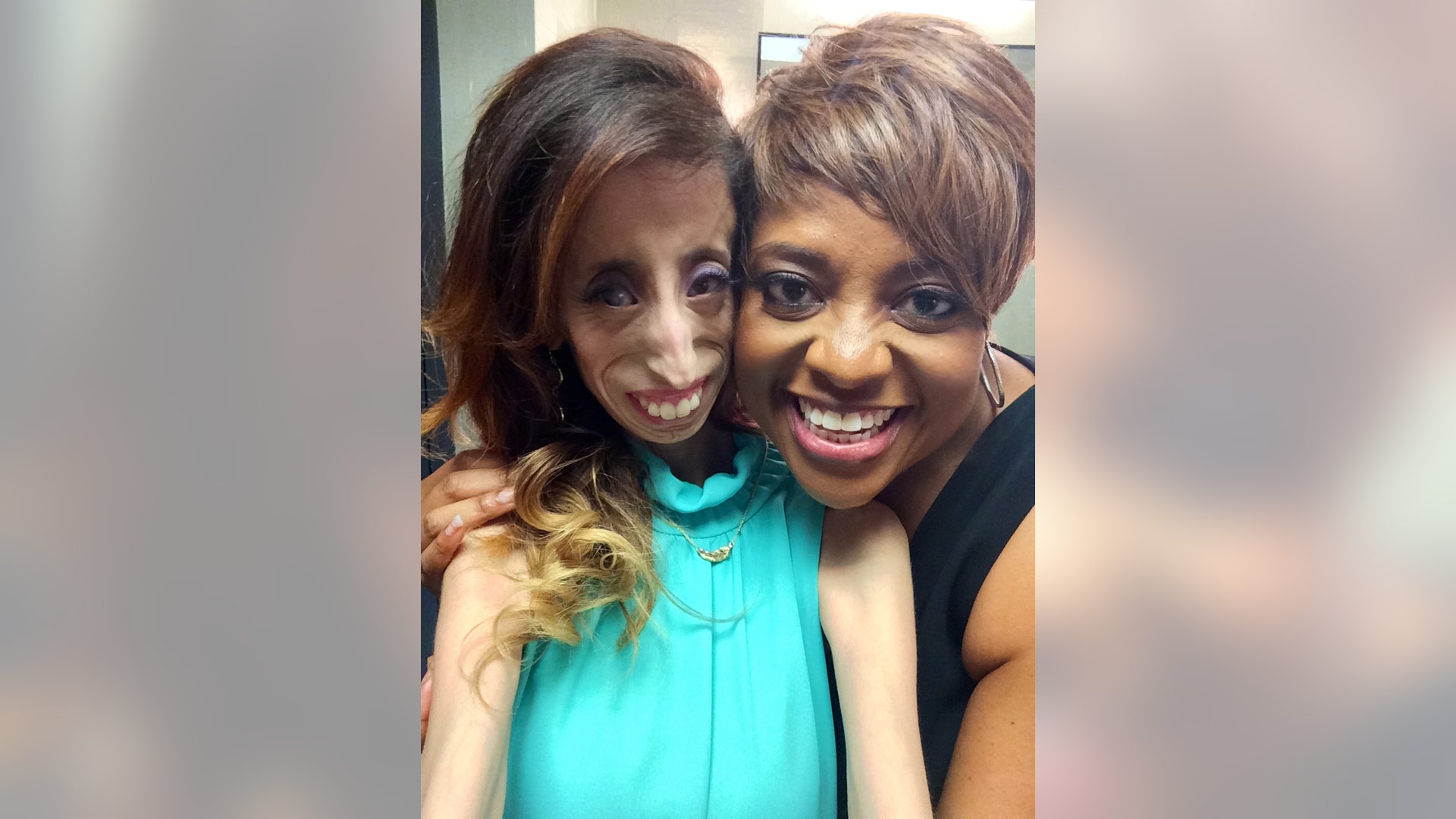From Worlds Ugliest Woman To Motivational Speaker And Author Fox News