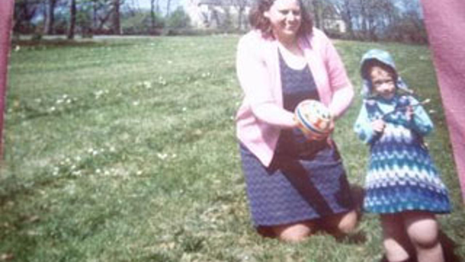 The Woman With 200-Pound Legs | Fox News