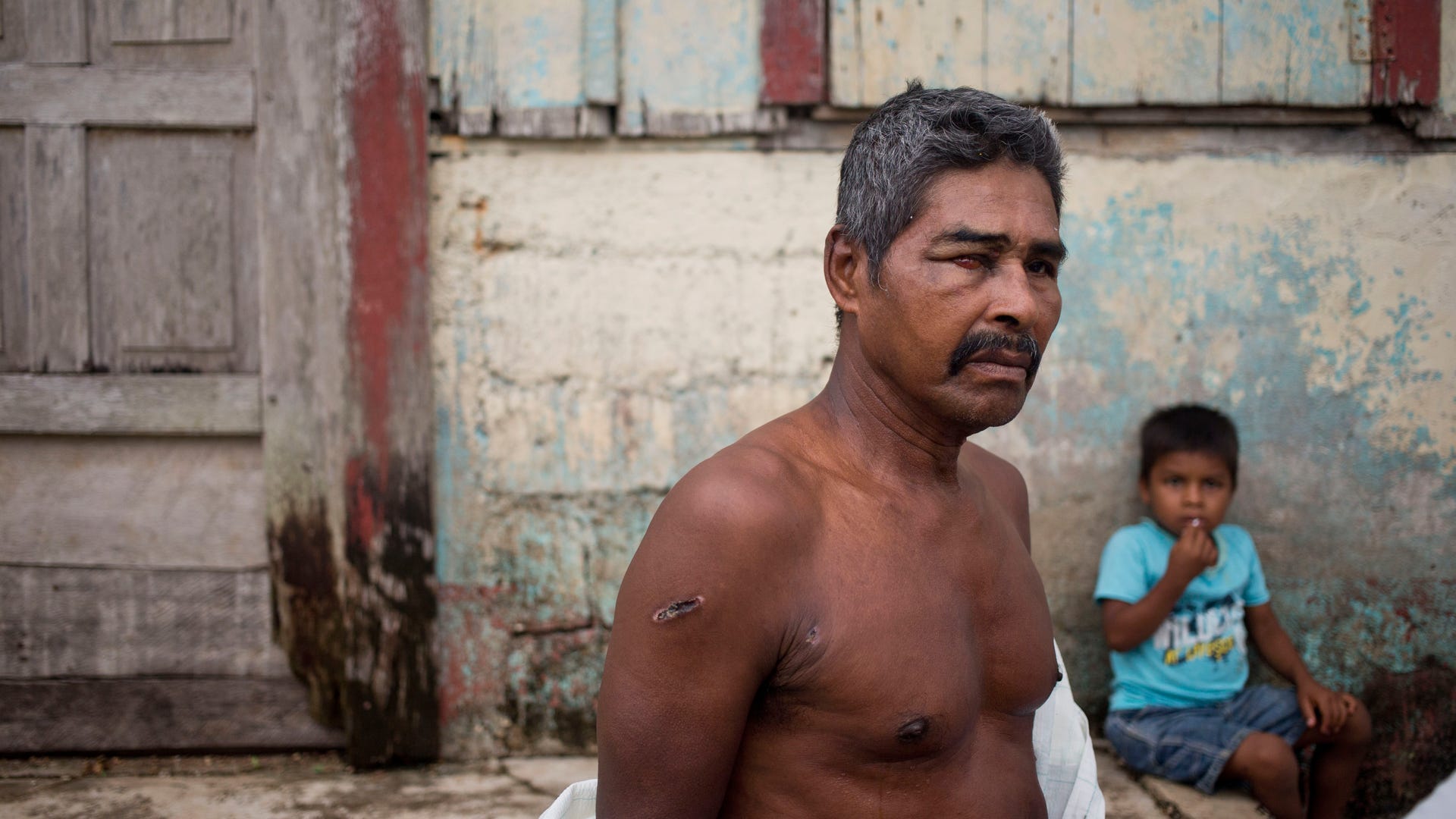 Miskito people take up in arms in Nicaragua | Fox News