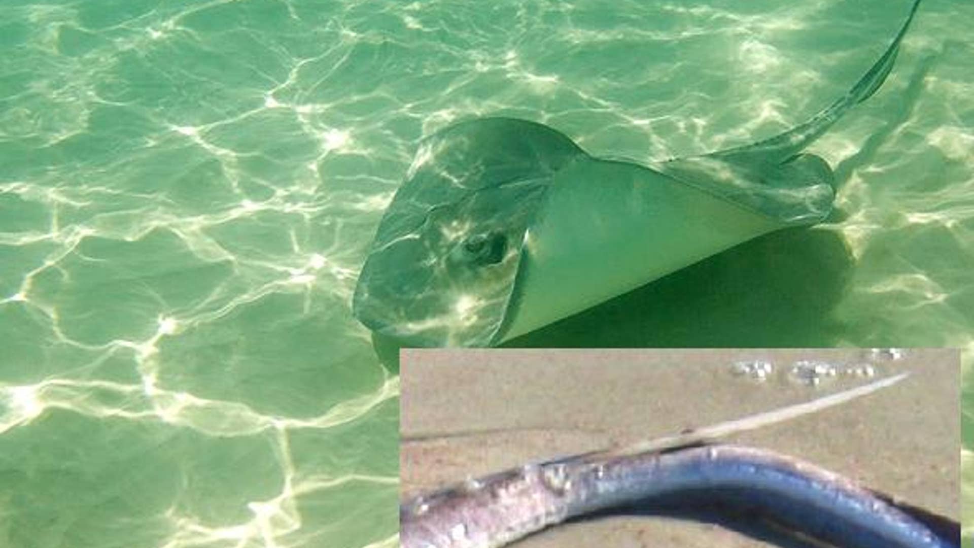 Things That Sting (and Bite!) | Fox News