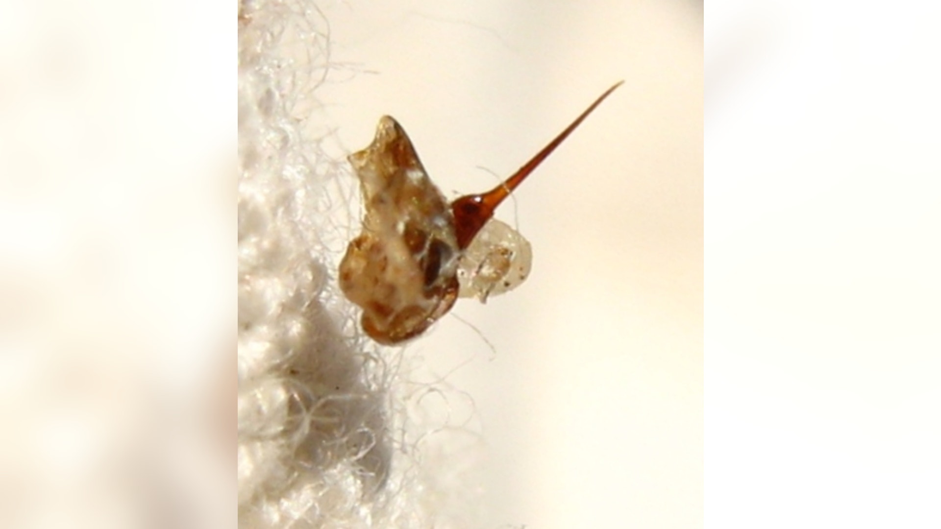 Things That Sting (and Bite!) | Fox News