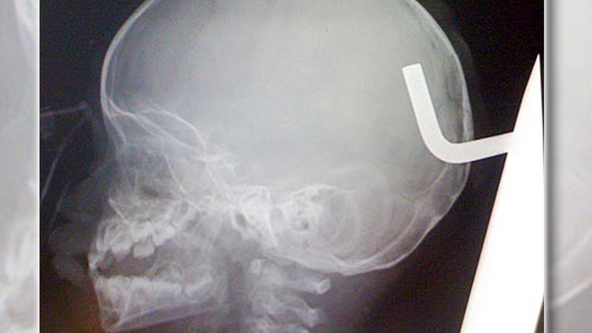 Outrageous injuries | Fox News