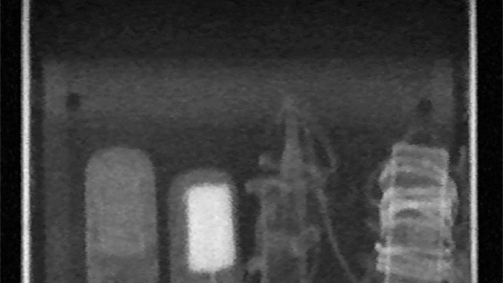 Z Backscatter Vans | Fox News