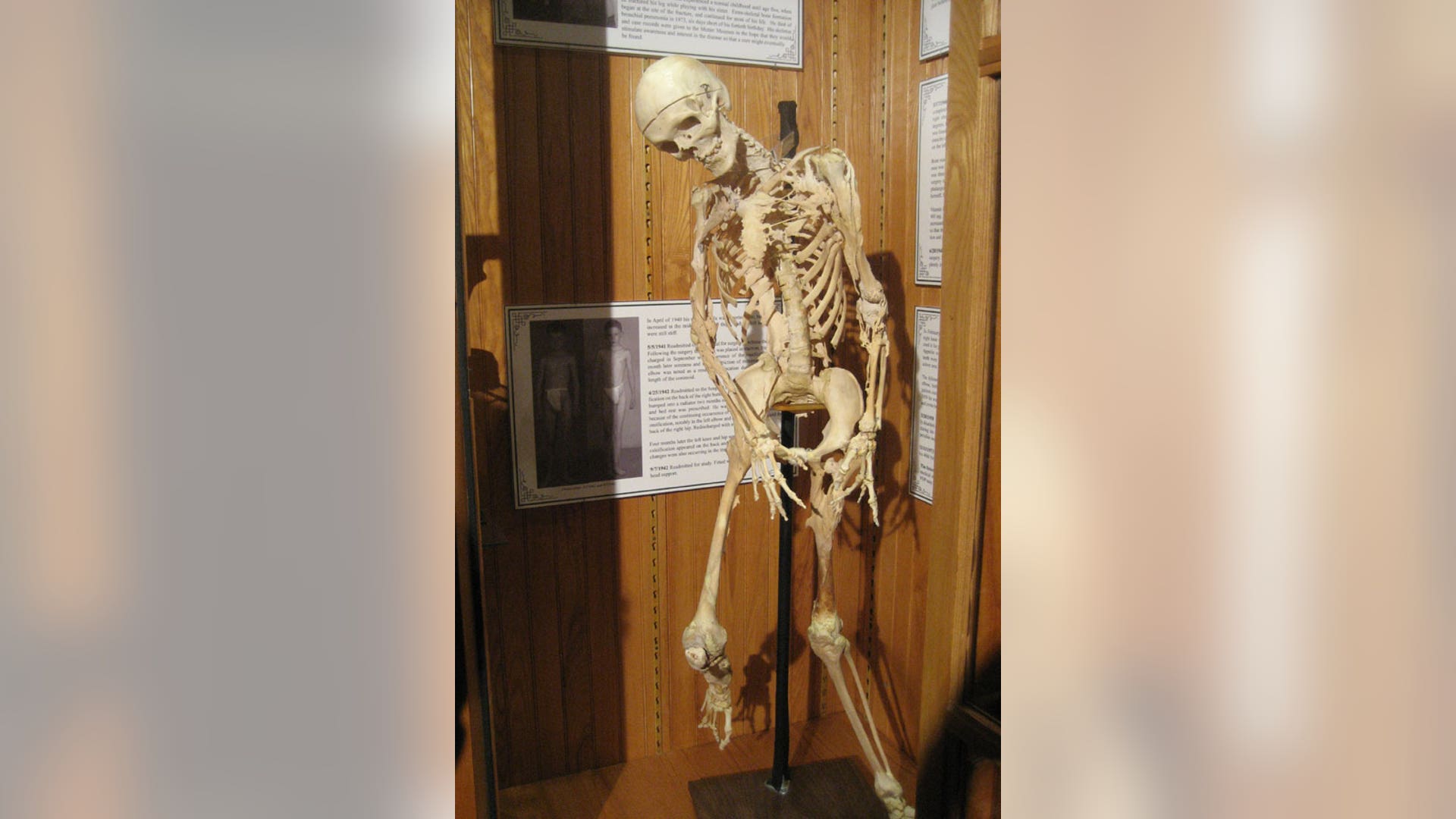 Freaky Medical Marvels | Fox News