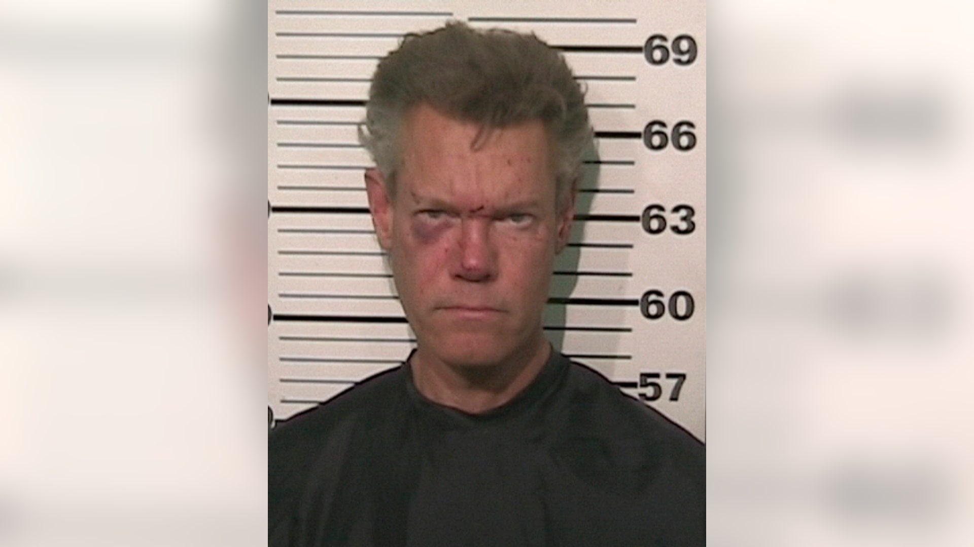 Country star scandals! | Fox News