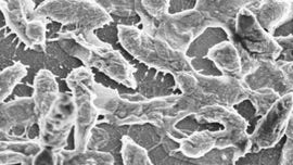 Toddler suffering from hallucinations, seizures diagnosed with rare ...