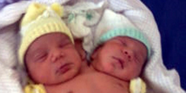 Docs: No Surgery for Twins With 2 Heads, 1 Body | Fox News
