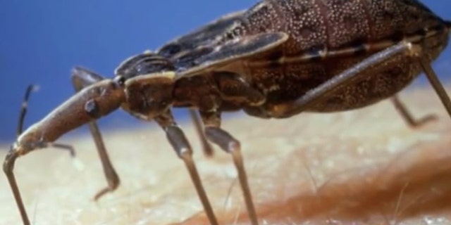 300,000 people in U.S. have Chagas disease as country unsure how to ...