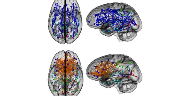 How men's brains are wired differently than women's | Fox News