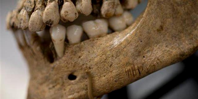 Here's why cannibalism is bad for your health | Fox News