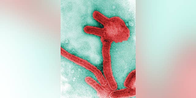3 typhoid cases in Colorado tied to restaurant | Fox News