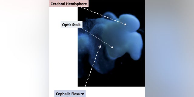 Researchers create lab-grown brain using human skin cells | Fox News