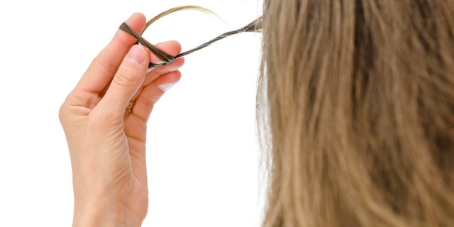 Rapunzel Syndrome Caused Womans Odd Symptoms Fox News